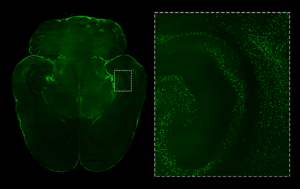 c-FOS+ Brain Mapping - LifeCanvas Technologies