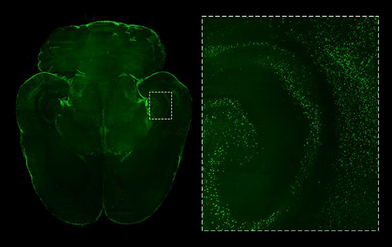 c-FOS+ Brain Mapping - LifeCanvas Technologies