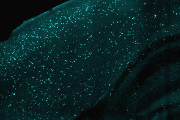 3D labeling & imaging of Neuropeptide Y (NPY) localization