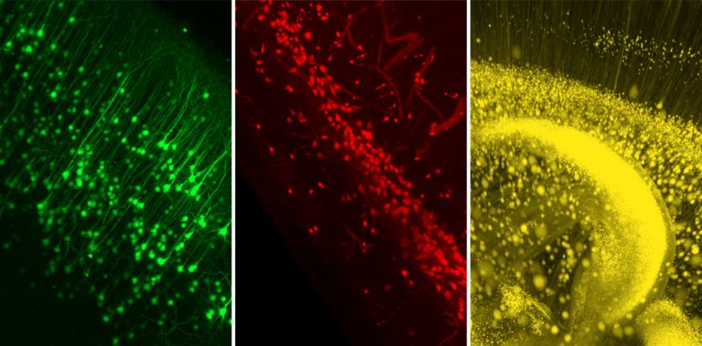 3D AAV Biodistribution Mapping - LifeCanvas Technologies