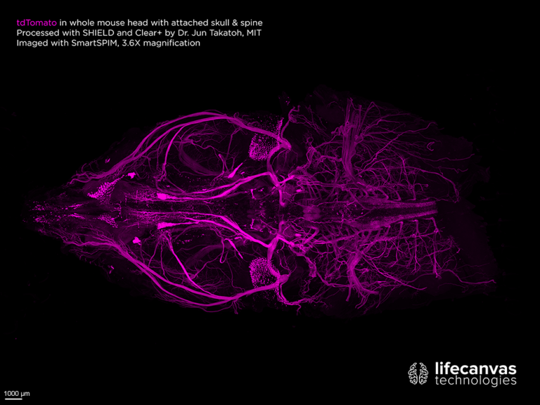 Light Sheet vs. Confocal Microscopy for 3D Imaging