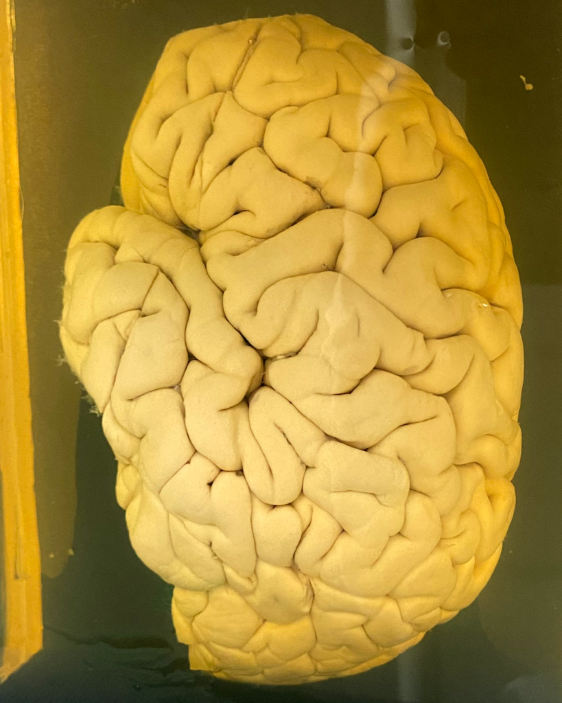 Precision sectioning of human and non-human primate brains with ...