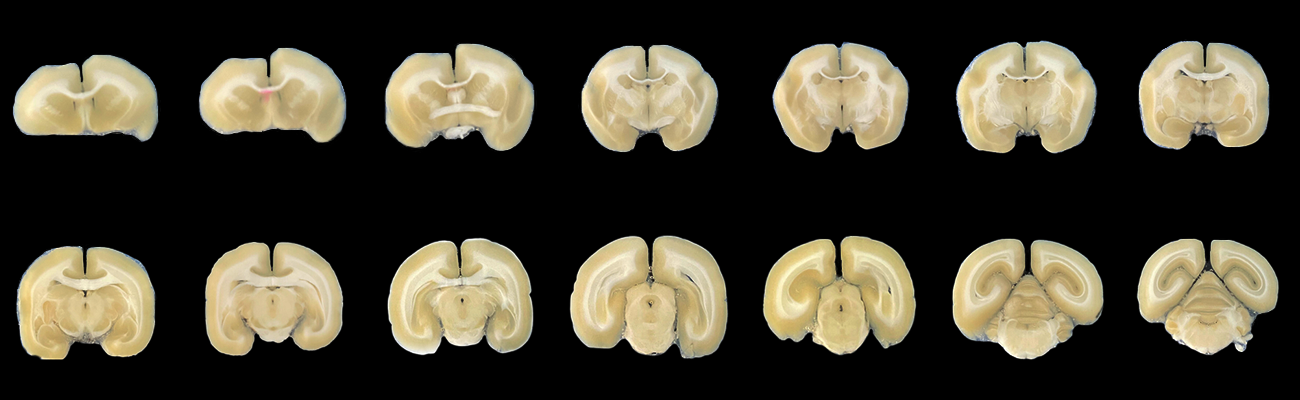 Precision sectioning of human and non-human primate brains with ...