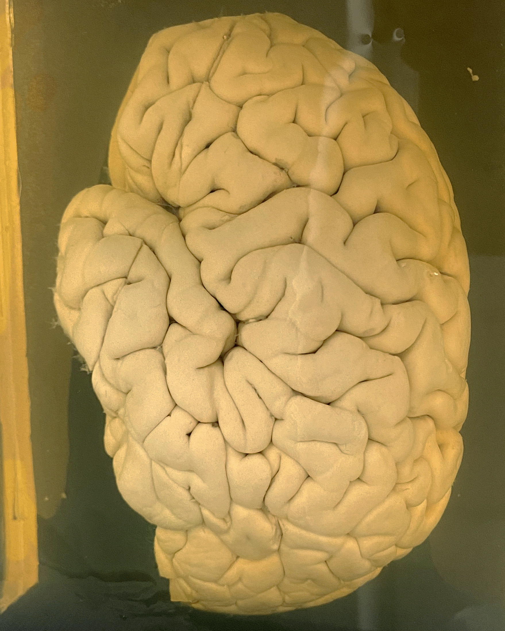 Precision sectioning of human and non-human primate brains with ...