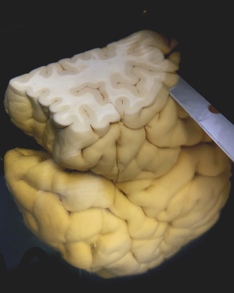 Precision sectioning of human and non-human primate brains with ...