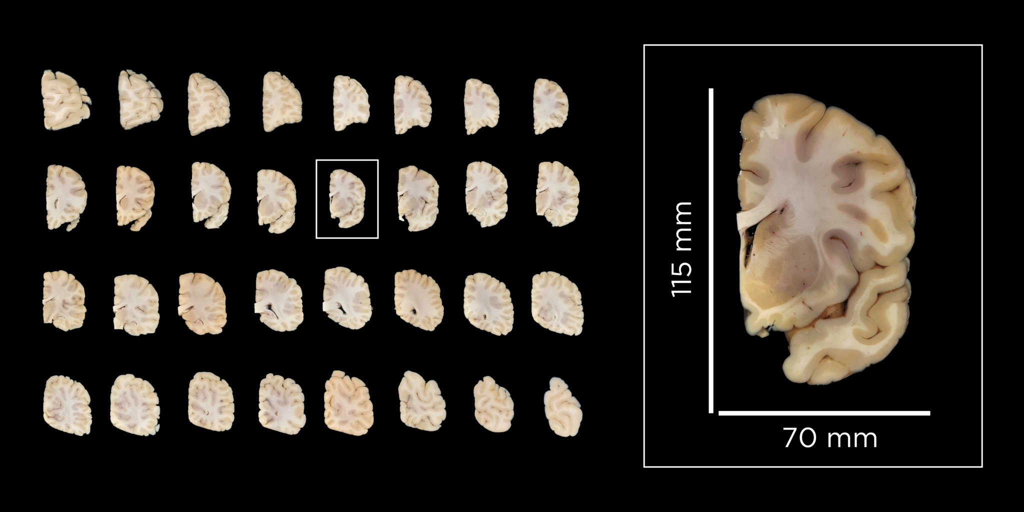 Precision sectioning of human and non-human primate brains with ...