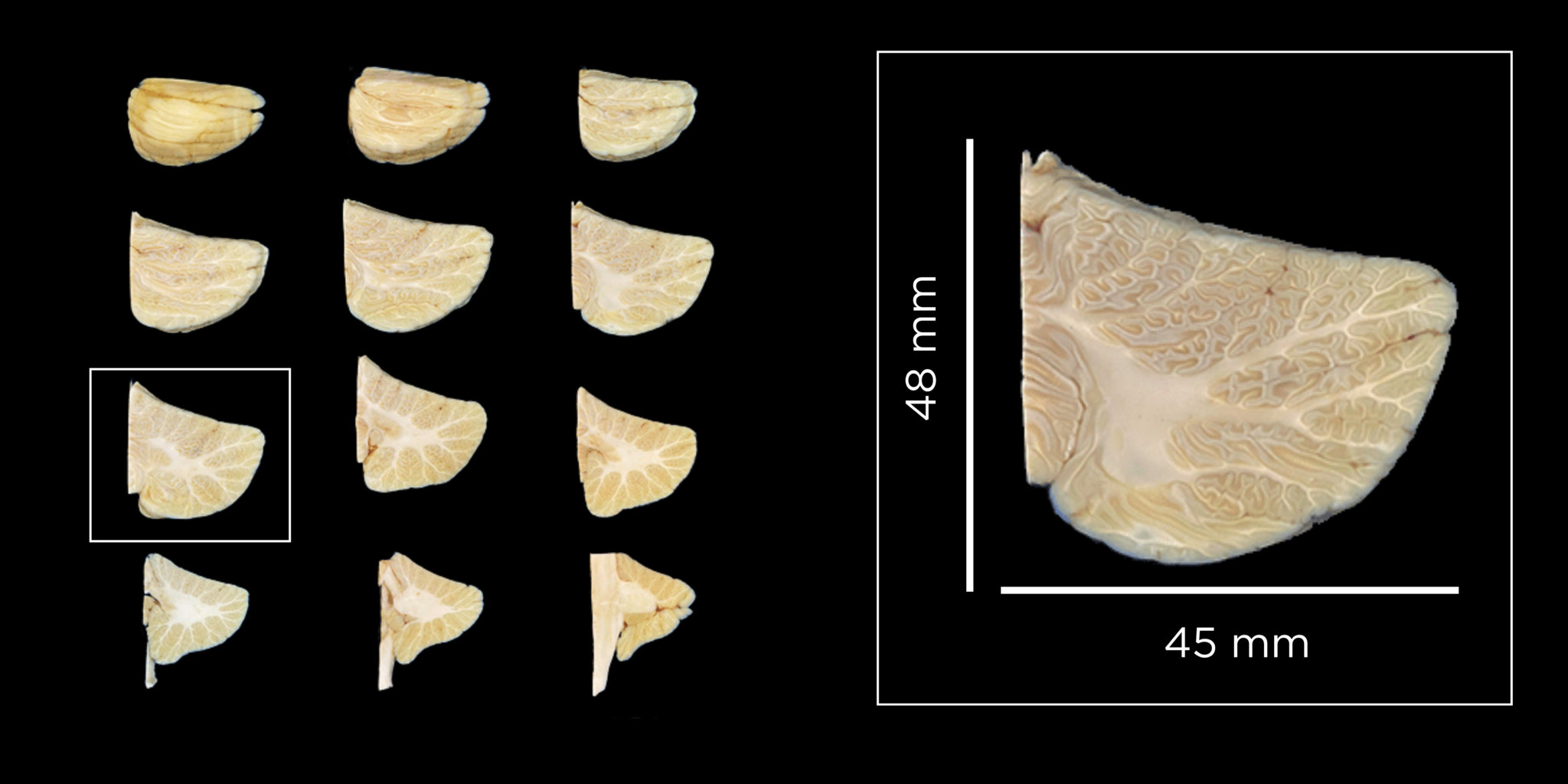 Precision sectioning of human and non-human primate brains with ...
