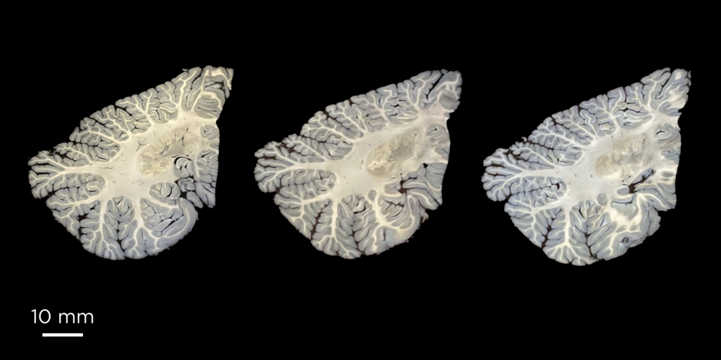 Precision sectioning of human and non-human primate brains with ...
