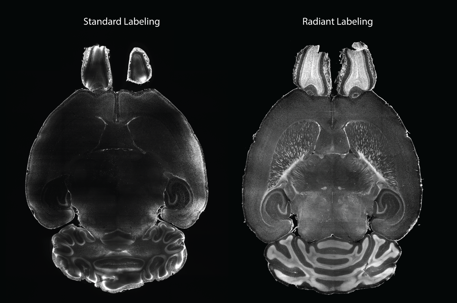 Tissue Clearing & Labeling with SmartBatch+