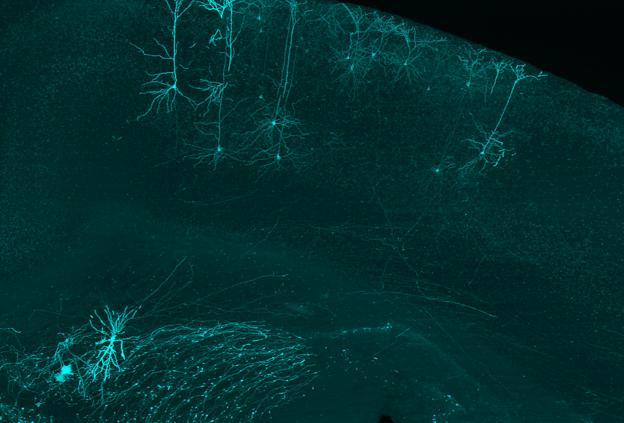 Phenotype Peripheral Nerve Innervation Patterns - LifeCanvas Technologies