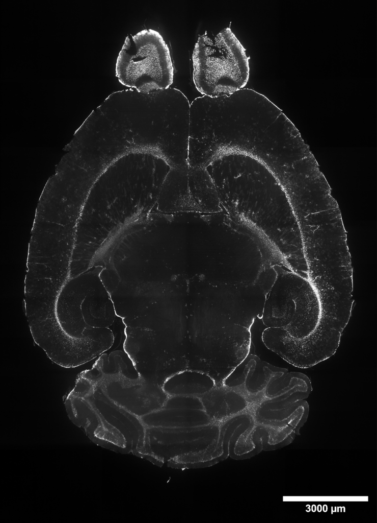 Mouse Brain: Mouse GFAP LifeCanvas Technologies