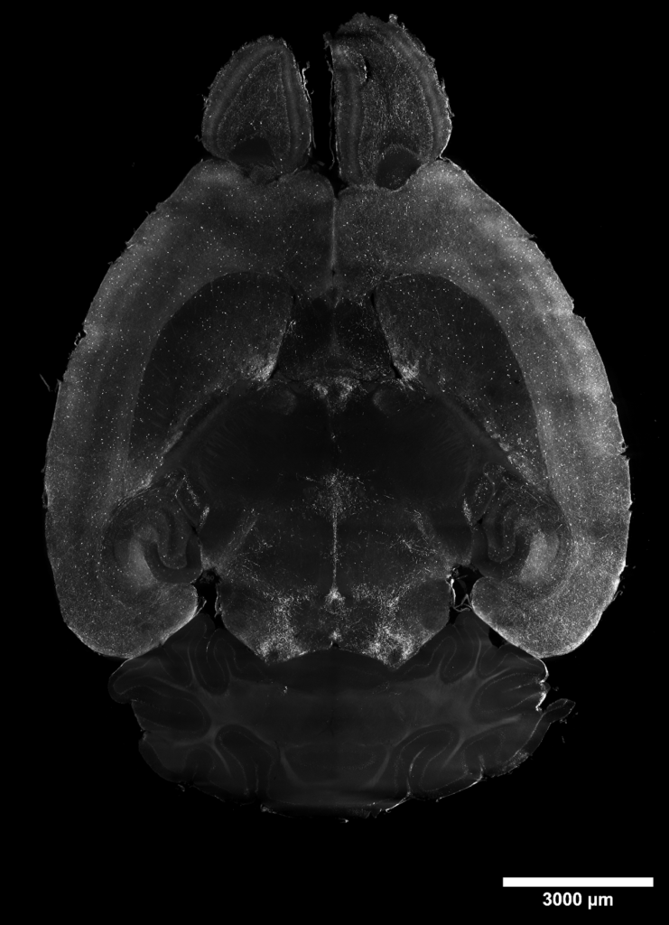Mouse Brain: Rabbit Neuropeptide Y LifeCanvas Technologies
