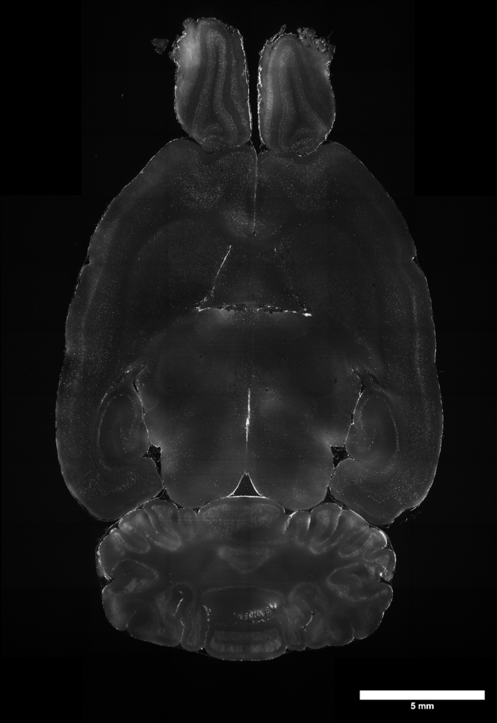 Rat Brain: Rabbit c-Fos LifeCanvas Technologies