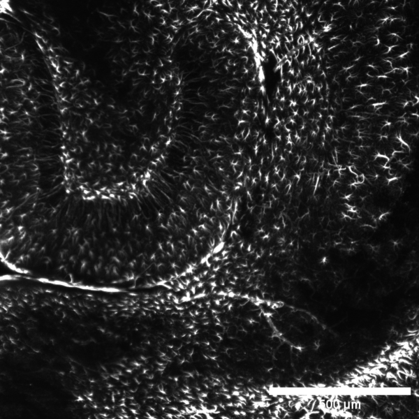 Mouse Brain: Rat GFAP LifeCanvas Technologies