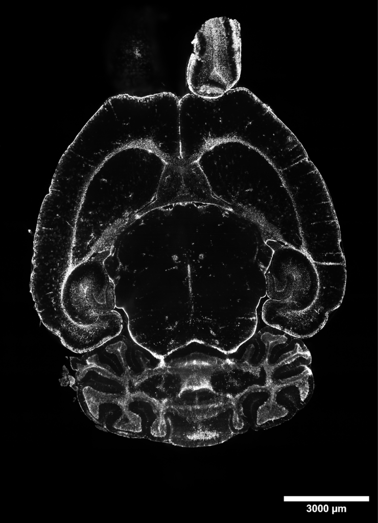 Mouse Brain: Rat GFAP LifeCanvas Technologies