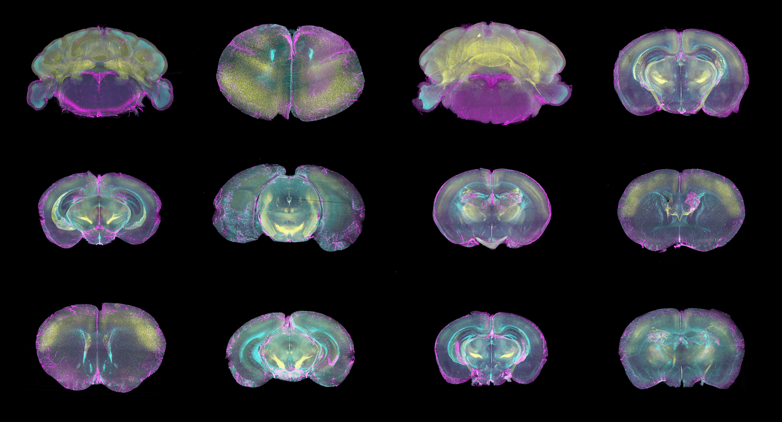 LifeCanvas launches open-top light sheet microscope for streamlined 3D ...
